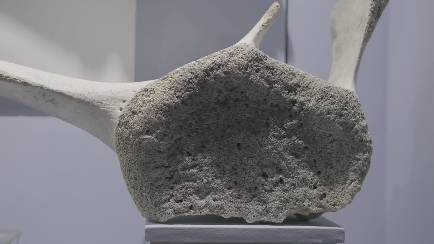 plantilla con toc lateral – REDMEDA